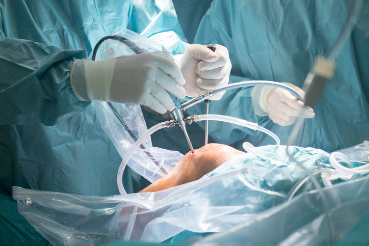 Advanced Arthroscopy for Safety & Cost-Effective Solutions | Medtech