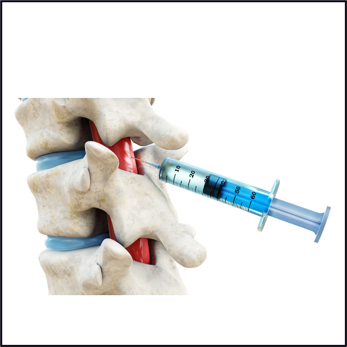 Nerve Block Kits for Anaesthetists: Safe & Reliable Solutions | Medtech