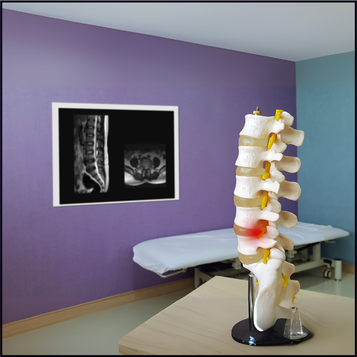 Spine Endoscopy Instruments for Neurosurgeons | Medtech