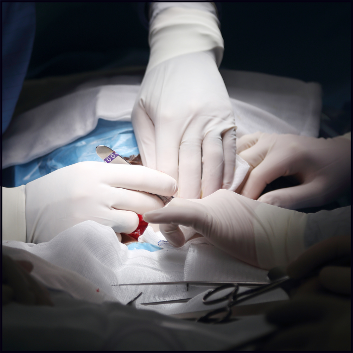 Innovative Biosurgery Solutions for General Surgeons | Medtech
