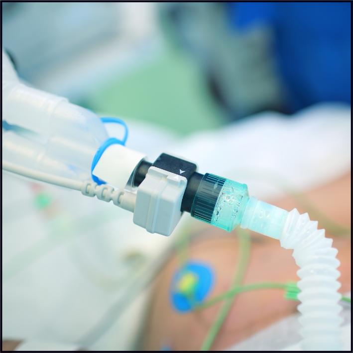 Reliable Breathing Circuits for Safe Anaesthesia Procedures | Medtech